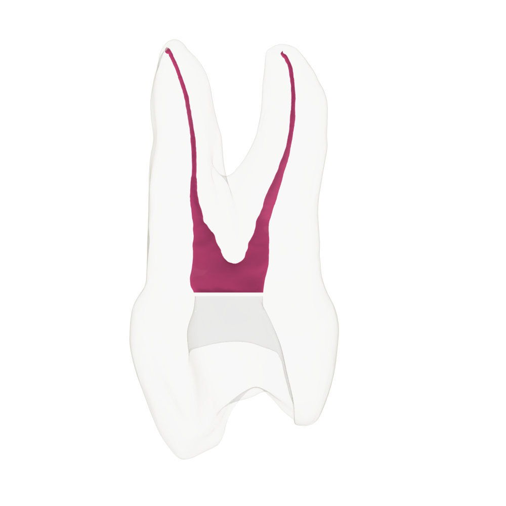 EndoTooth 14 Mesio-Occlusal Access