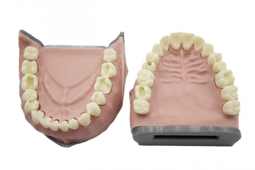 Monomaterial Teeth with Cavities - Dental Training Models